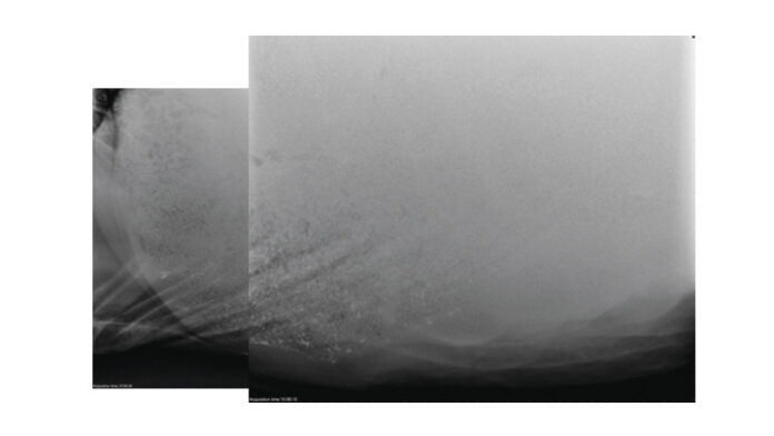 Sand Colic 101 - Horse Illustrated